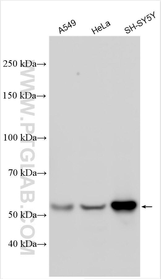 DFNA5/GSDME antibody (13075-1-AP) | Proteintech