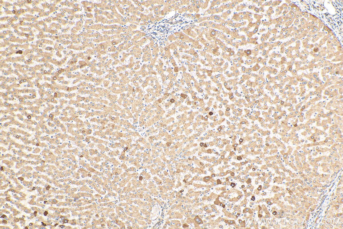DGAT1 antibody (11561-1-AP) | Proteintech