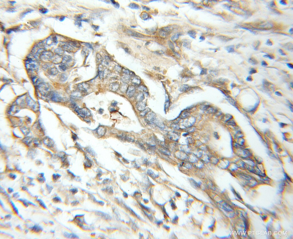 DGAT1 antibody (11561-1-AP) | Proteintech