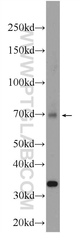 DHX35 antibody (24923-1-AP) | Proteintech