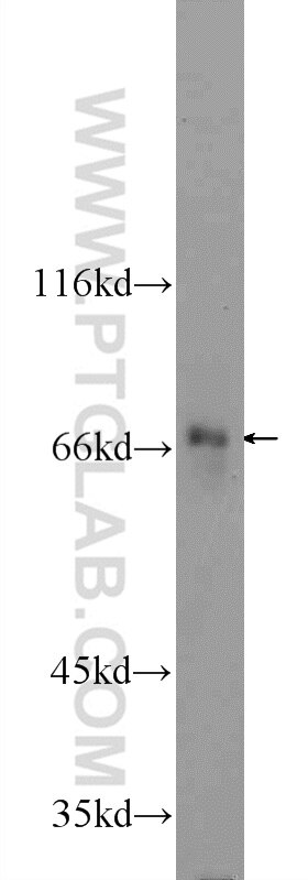 DHX35 antibody (24923-1-AP) | Proteintech