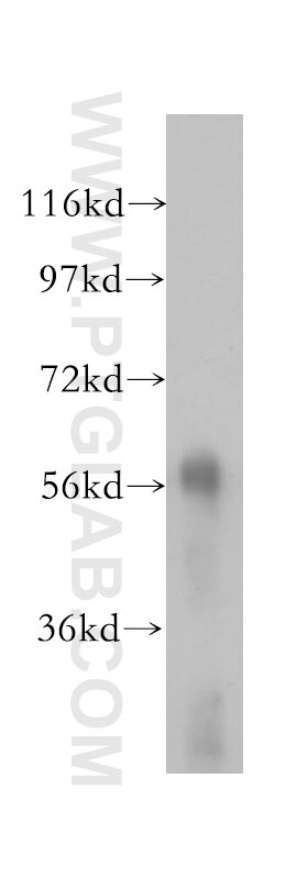 DIDO1 Fusion Protein Ag7826 | Proteintech