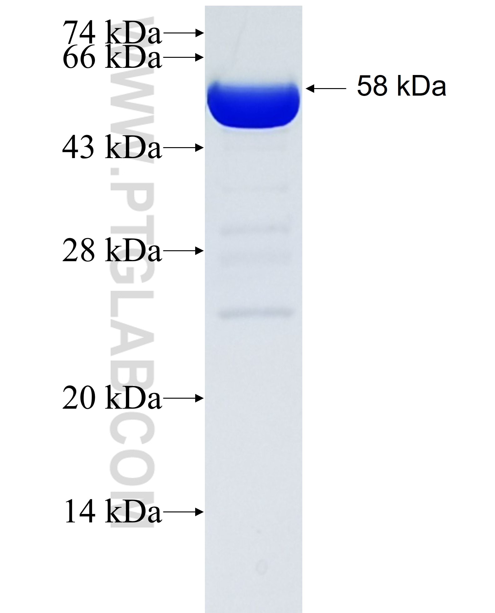 DIO3 Fusion Protein Ag34265 | Proteintech