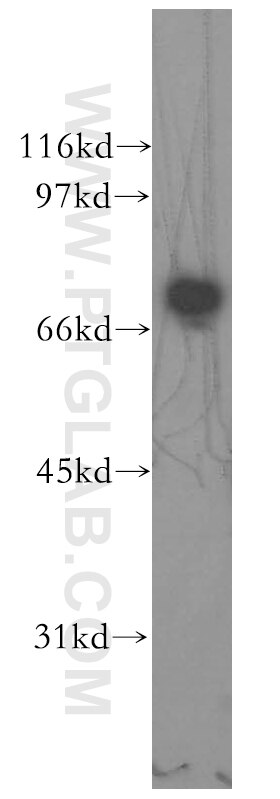 DLAT Fusion Protein Ag22831 | Proteintech