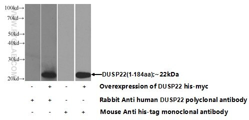 DUSP22 Fusion Protein Ag9831 | Proteintech