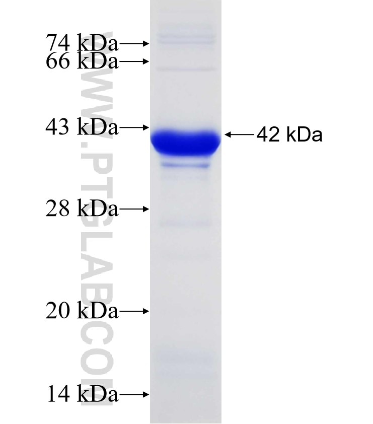 ECM1 Fusion Protein Ag29246 | Proteintech