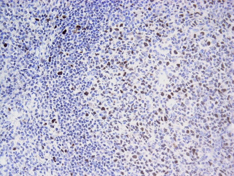 EED antibody (mAb) (Clone 41D) | Proteintech