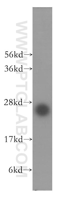 EMG1 antibody (11965-1-AP) | Proteintech