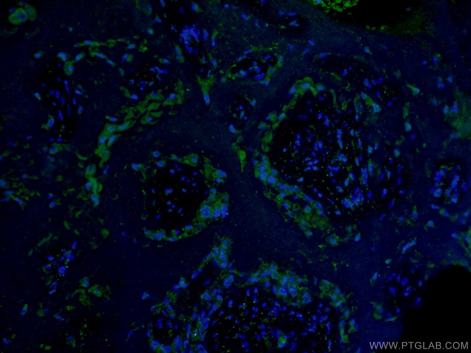 Endoglin/CD105 Antibody 10862-1-AP | Proteintech