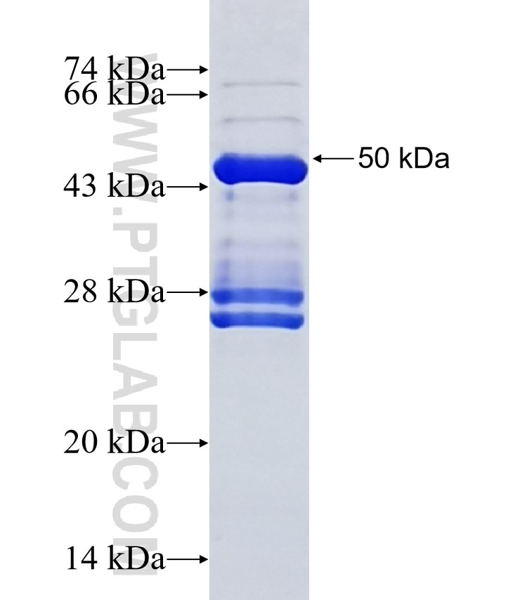 ENPP3 Fusion Protein Ag18813 | Proteintech