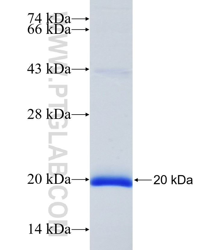 EPDR1 Fusion Protein Ag26333 | Proteintech