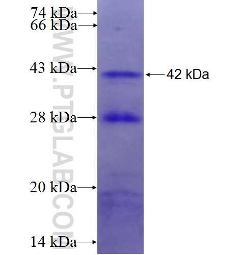 ERAP2 Fusion Protein Ag6351 | Proteintech
