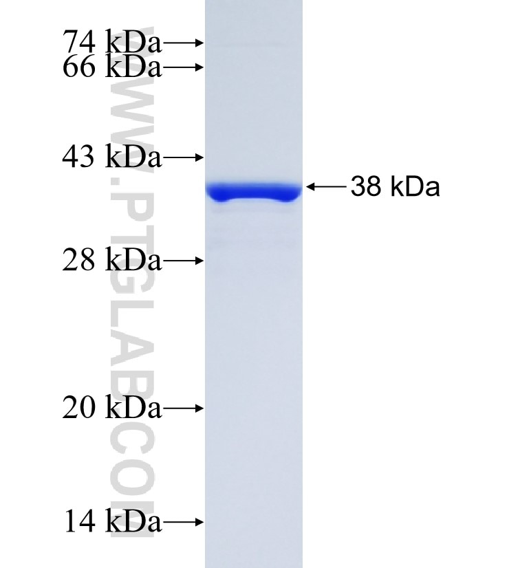 ERN2 Fusion Protein Ag29456 | Proteintech
