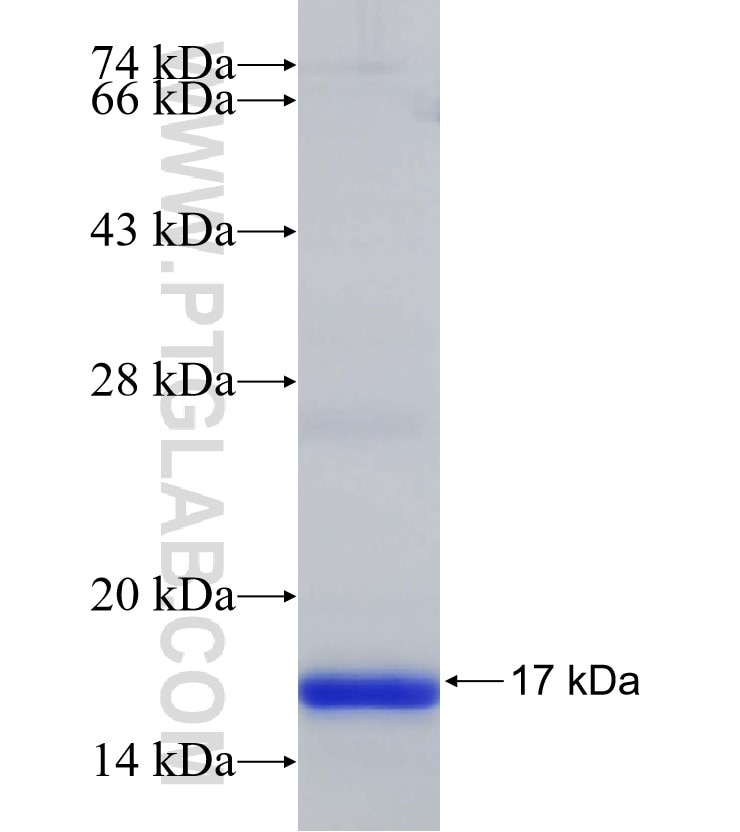 ERV3-1 ERV3 Fusion Protein Ag31235 | Proteintech