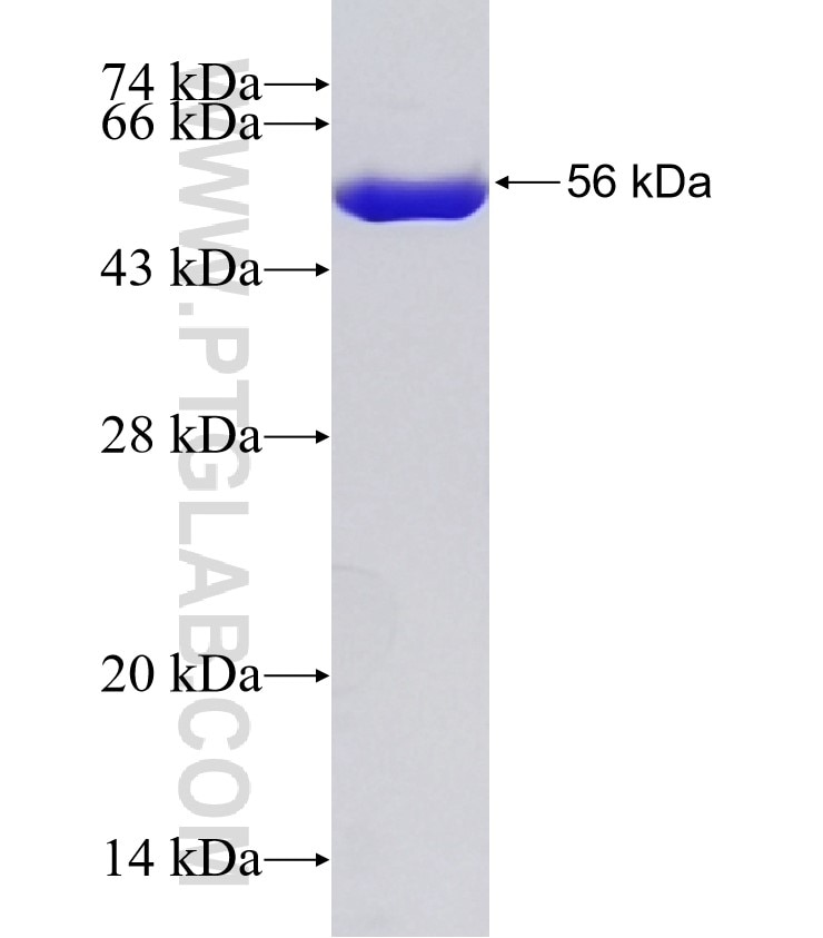Endo H Fusion Protein Ag32770 | Proteintech