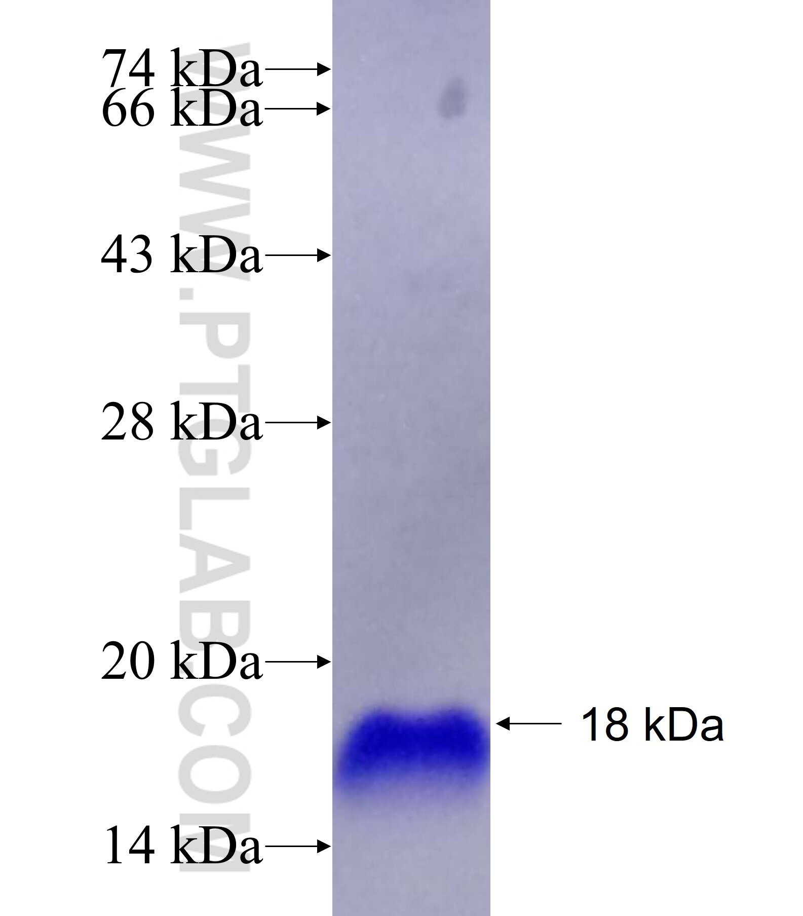 Ezrin Fusion Protein Ag23542 | Proteintech