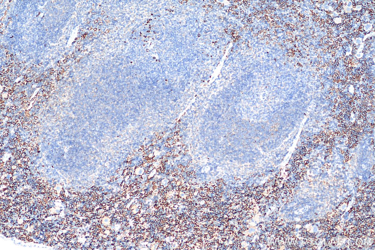 F4/80 antibody (81668-1-RR) | Proteintech