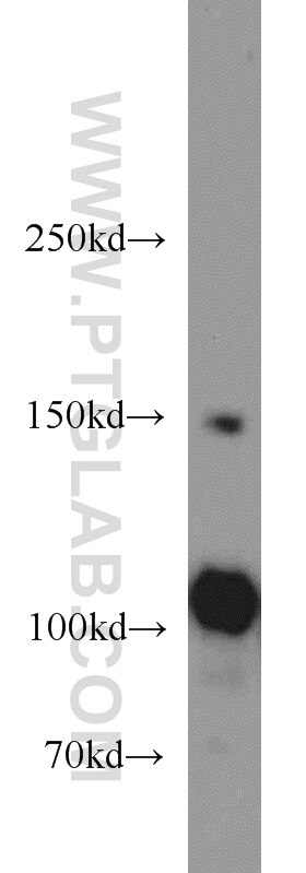 FAK antibody (12636-1-AP) | Proteintech