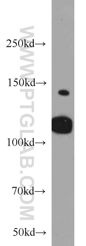 FAK antibody (12636-1-AP) | Proteintech