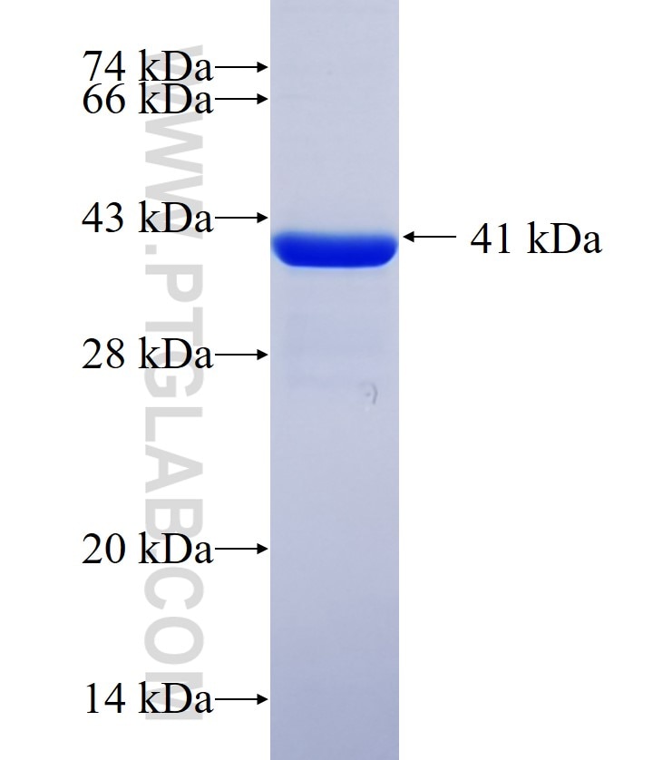 FBXO17 Fusion Protein Ag33125 | Proteintech