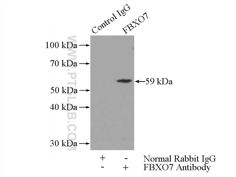 FBXO7 antibody (10696-1-AP) | Proteintech