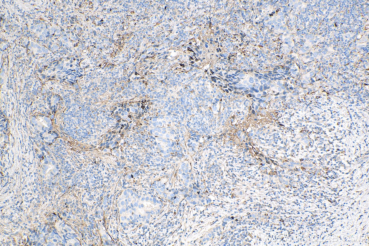 Fibronectin antibody (15613-1-AP) | Proteintech