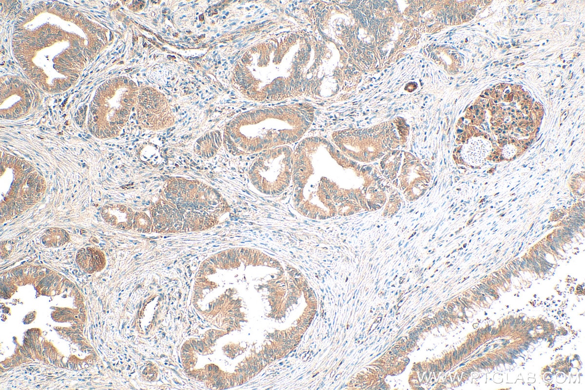 FRY antibody (32075-1-AP) | Proteintech