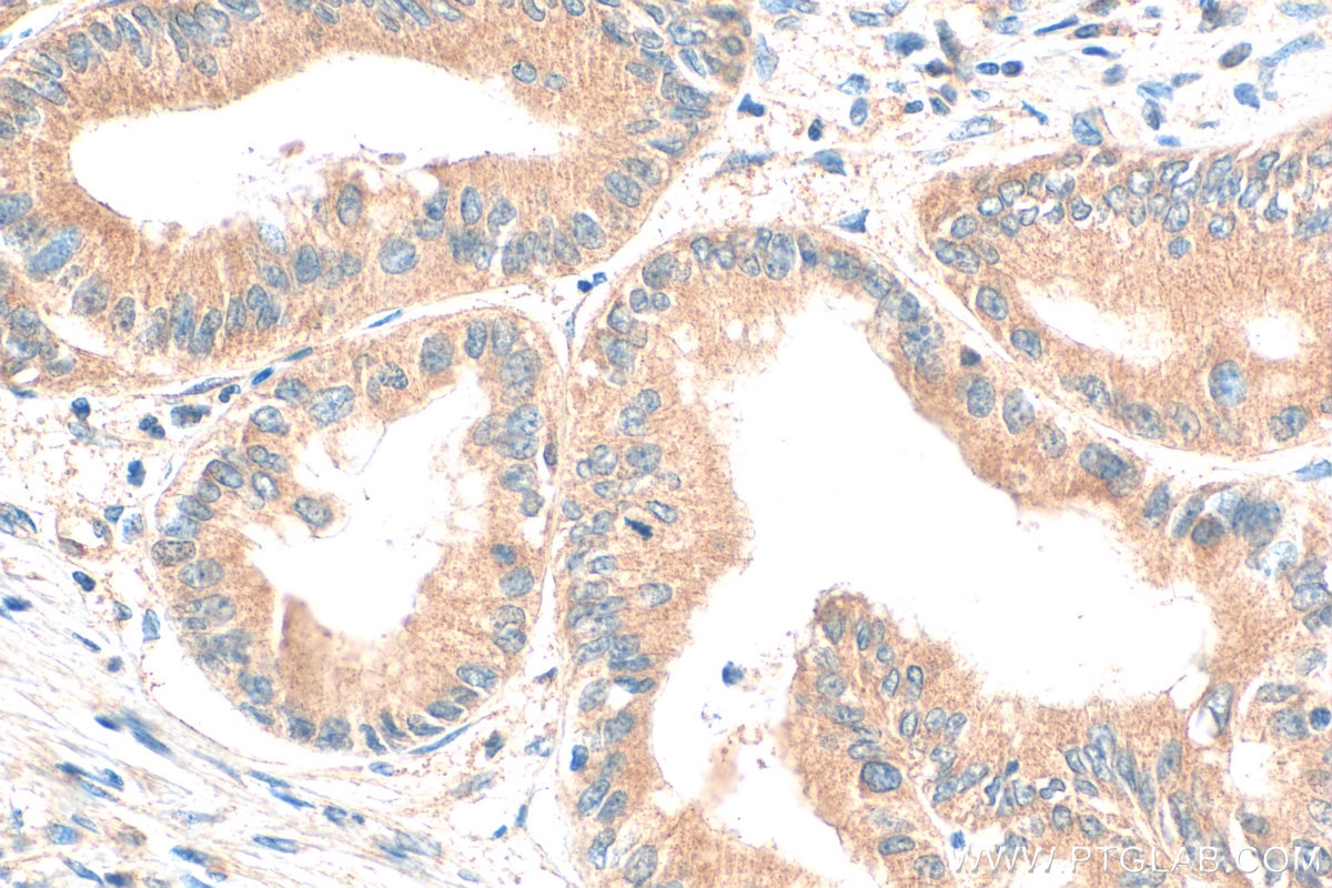 FRY antibody (32075-1-AP) | Proteintech