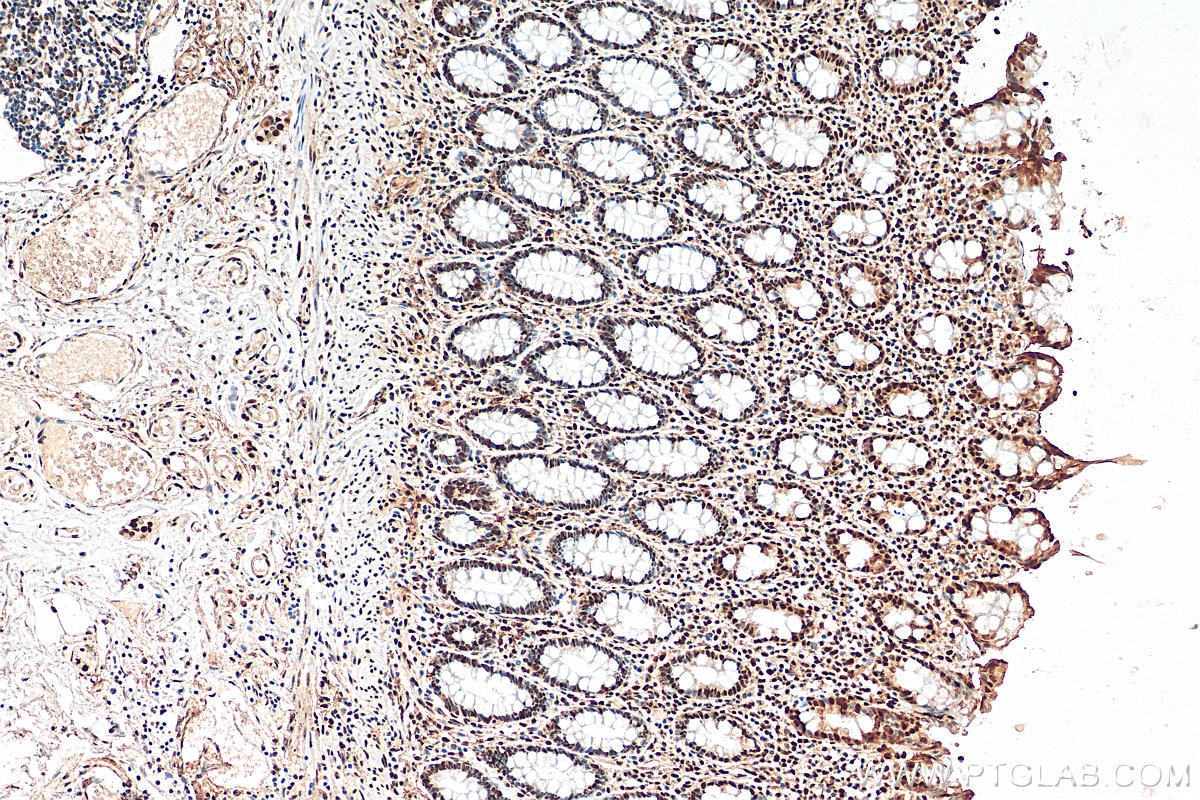 FUS/TLS Fusion Protein Ag31799 | Proteintech