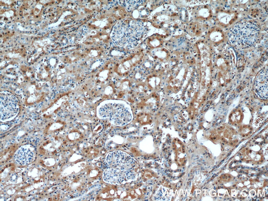 FXR1 antibody (13194-1-AP) | Proteintech