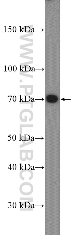 Frizzled 5 antibody (21519-1-AP) | Proteintech