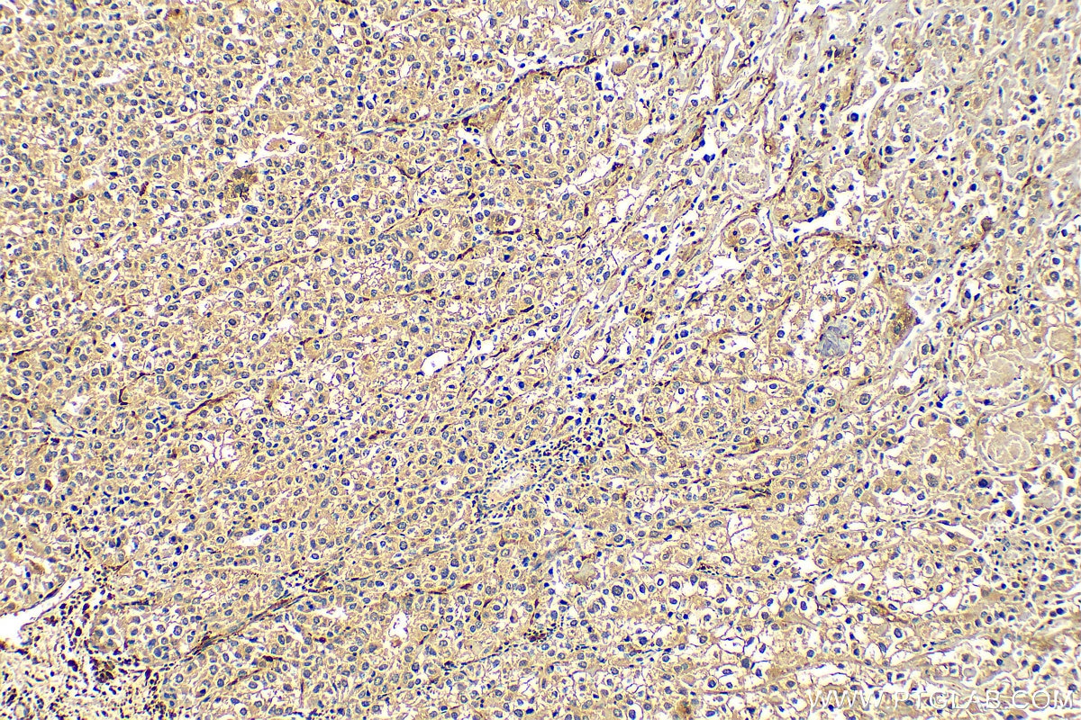 Factor XIIIa antibody (66325-1-PBS) | Proteintech