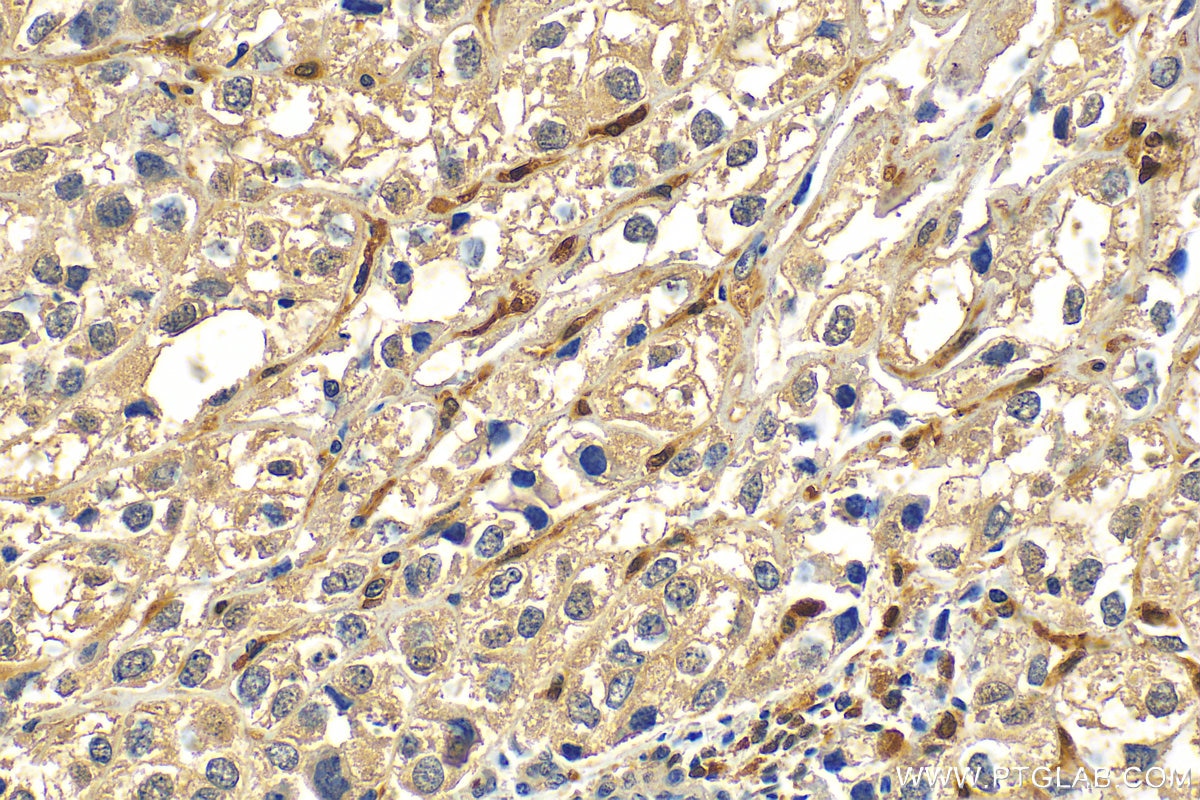 Factor XIIIa antibody (66325-1-PBS) | Proteintech