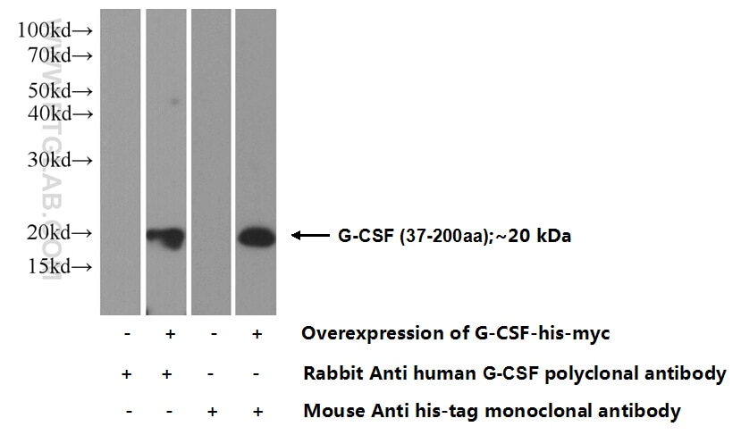 G-CSF Fusion Protein Ag10968 | Proteintech