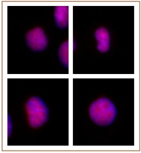 GATA-6 antibody (pAb) | Proteintech