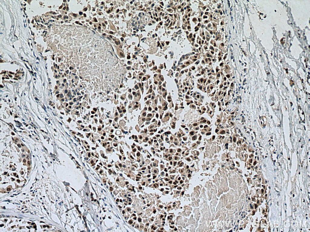 GATA3 antibody (10417-1-AP) | Proteintech