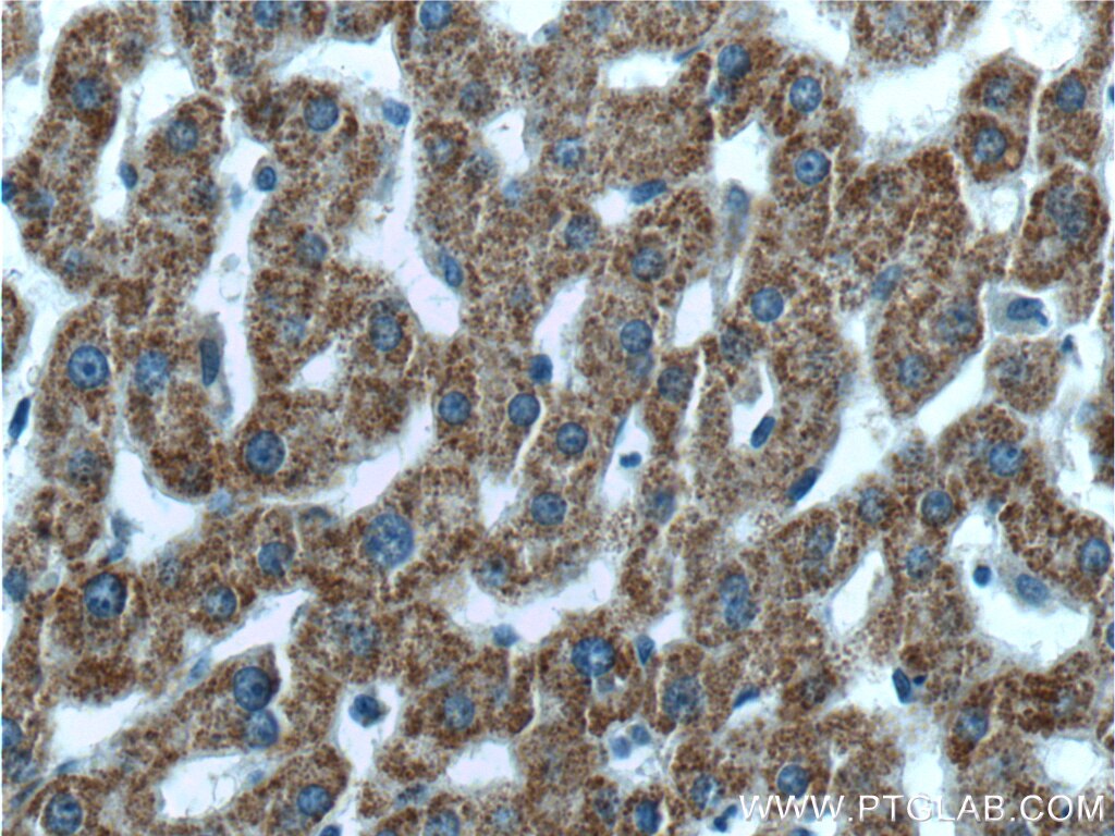GCDH antibody (14930-1-AP) | Proteintech