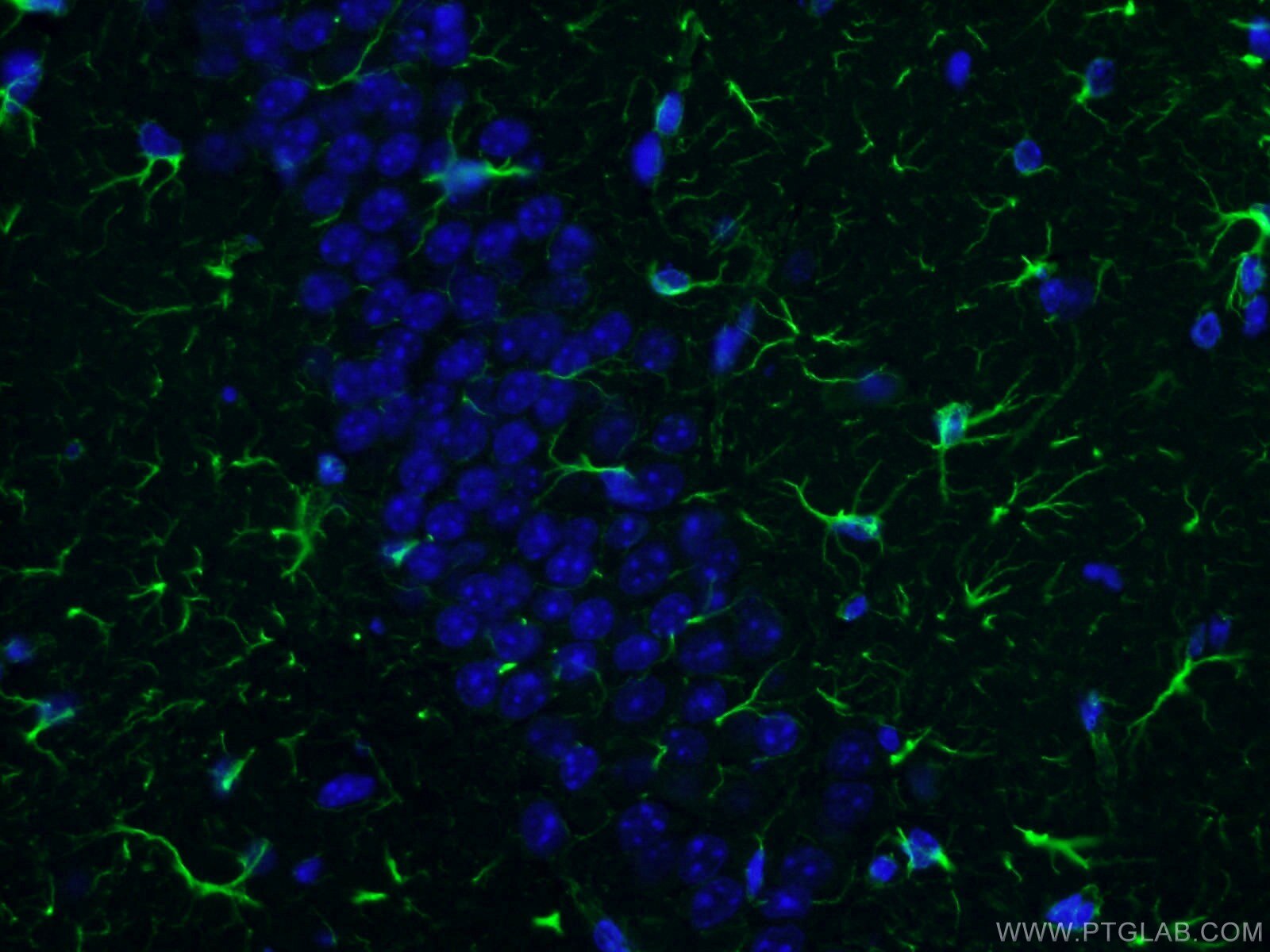 GFAP antibody (16825-1-AP) | Proteintech