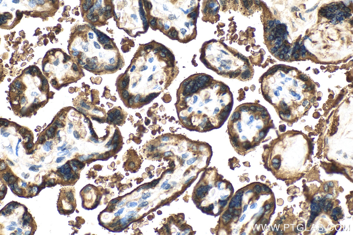 GH1 antibody (82813-2-RR) | Proteintech