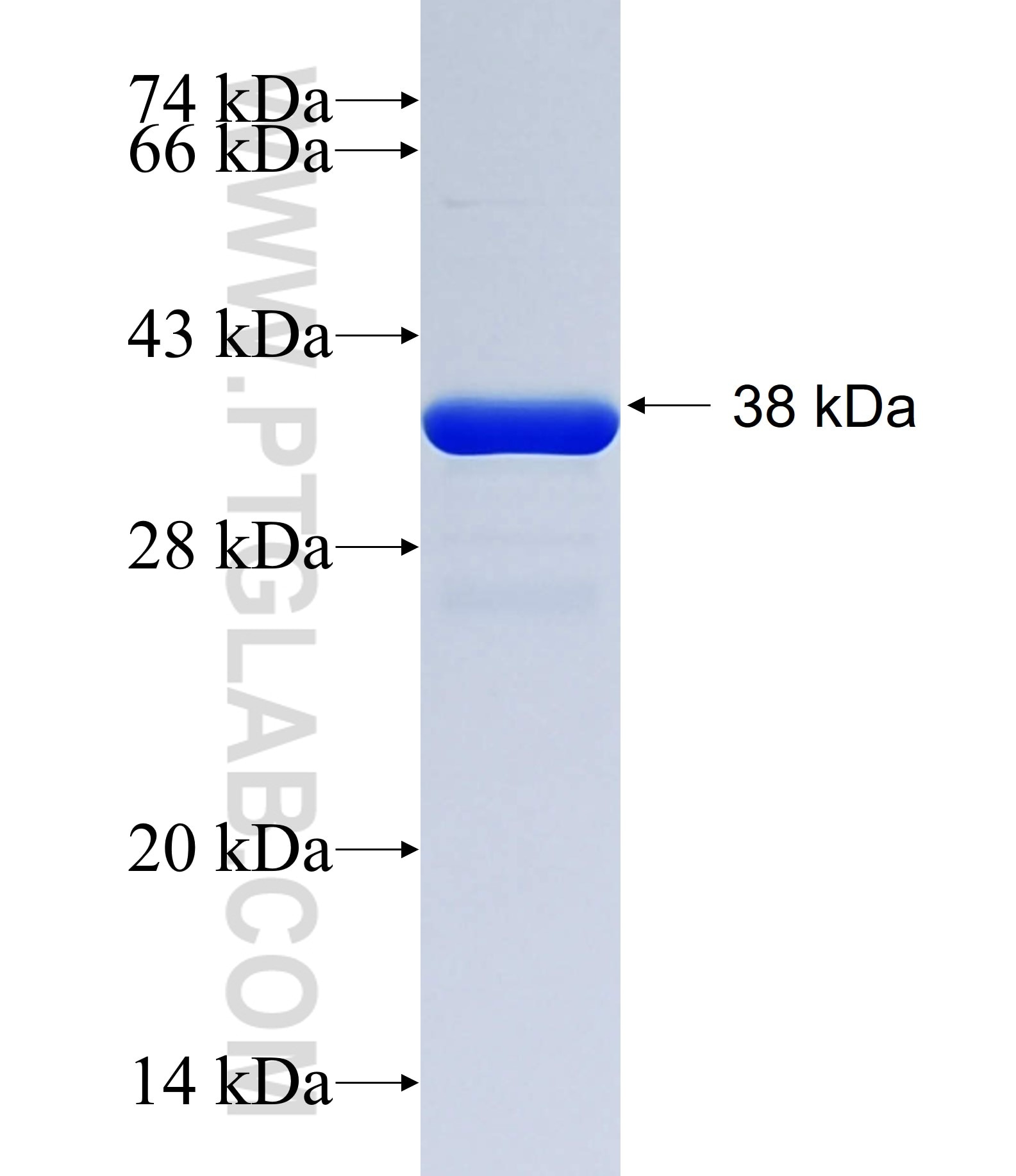 GIGYF1 Fusion Protein Ag34632 | Proteintech