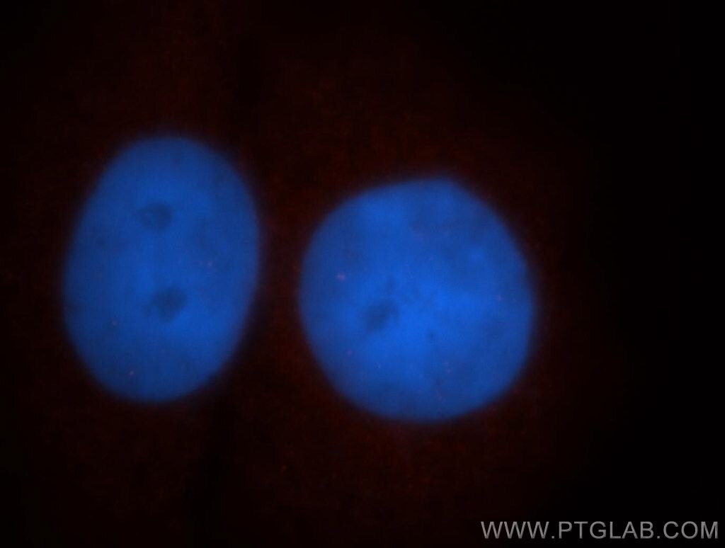 GNB1 Fusion Protein Ag0313 | Proteintech