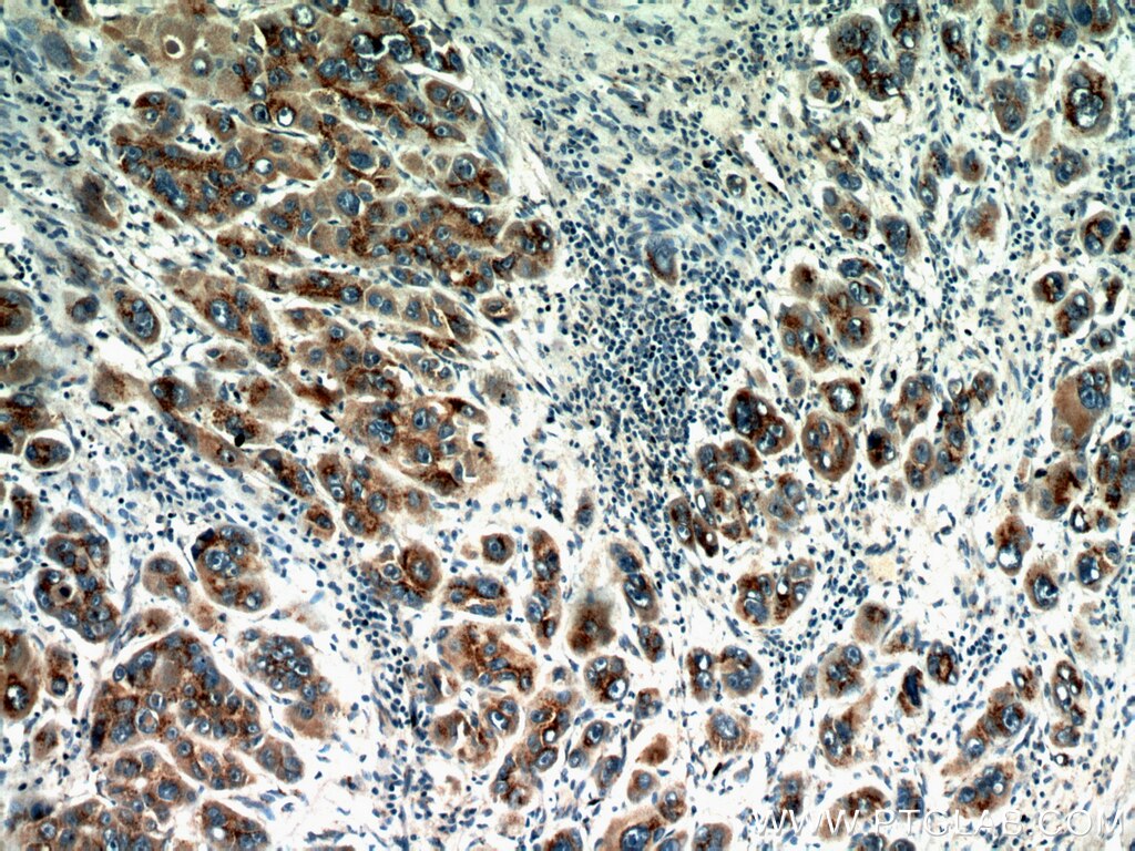 GP73/GOLPH2 antibody (15126-1-AP) | Proteintech
