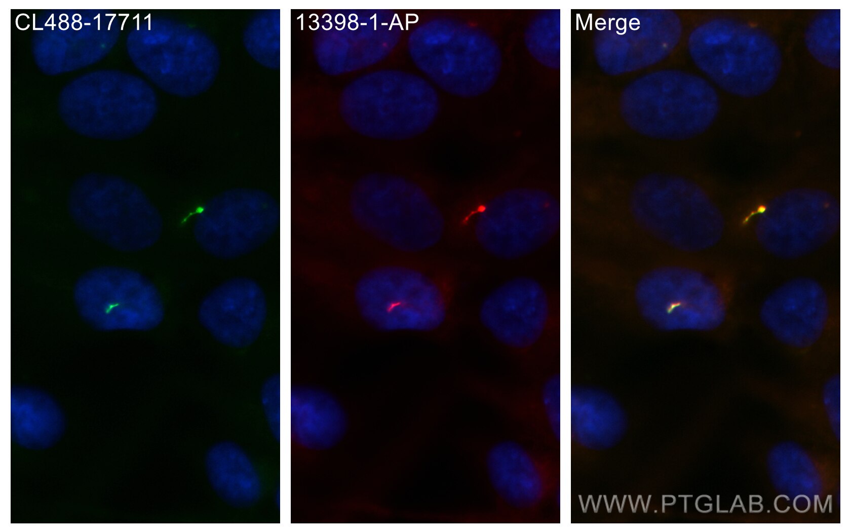 GPR161 Antikörper (13398-1-AP) | Proteintech