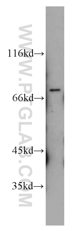 GRB10 antibody (10028-2-AP) | Proteintech