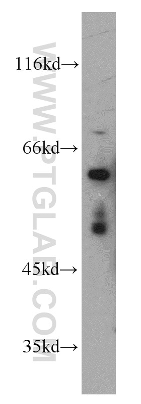 GRB10 antibody (10028-2-AP) | Proteintech