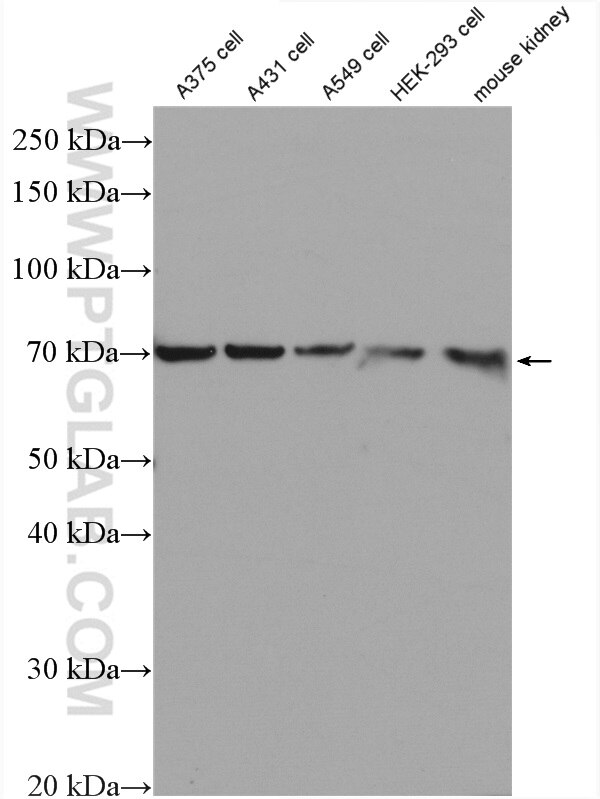 GSDMC Fusion Protein Ag33319 | Proteintech