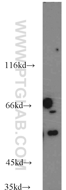 GSTCD Antibody 17502-1-AP | Proteintech