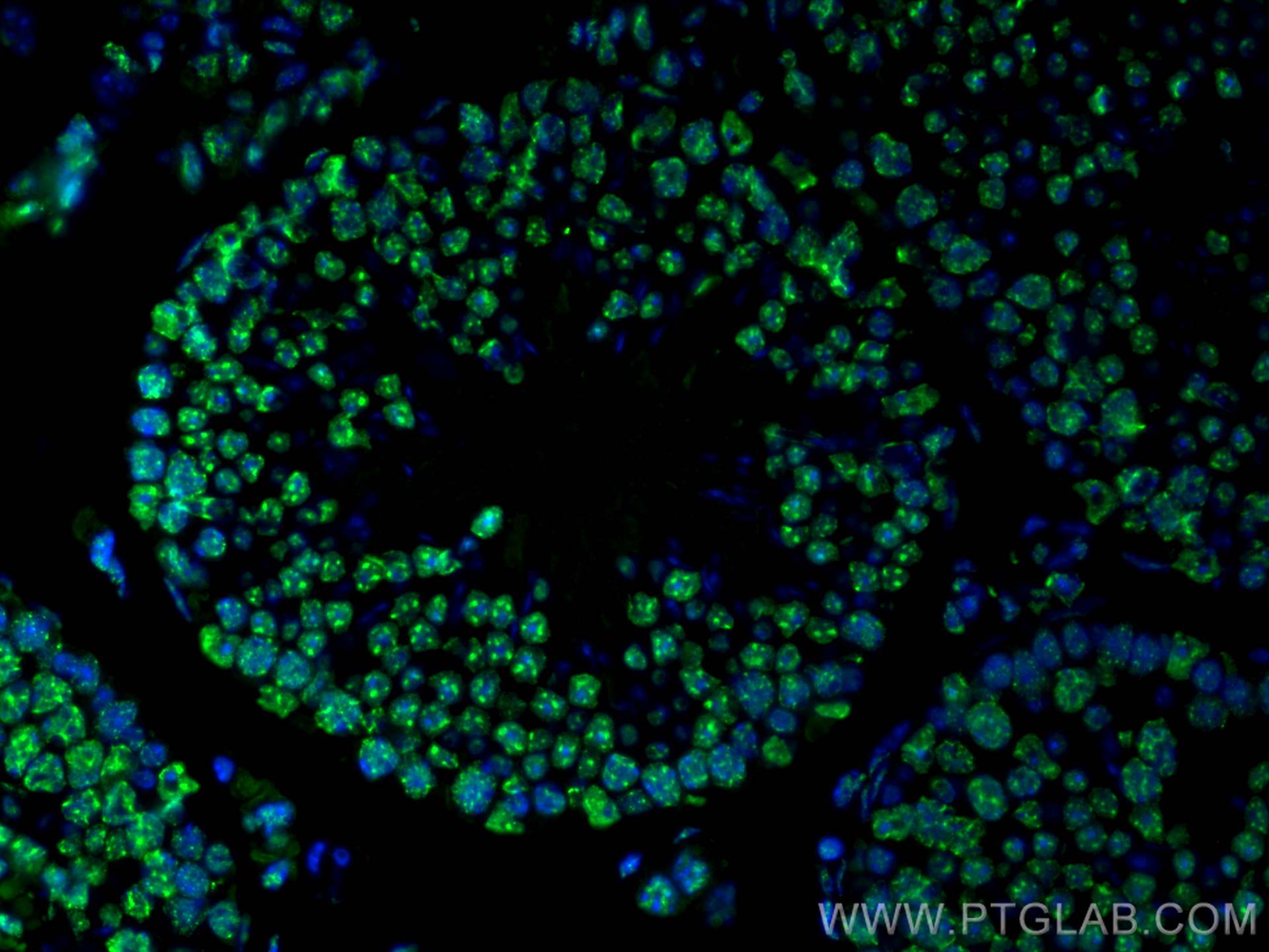 Phospho-Histone H3 (Ser10) antibody (66863-1-Ig) | Proteintech