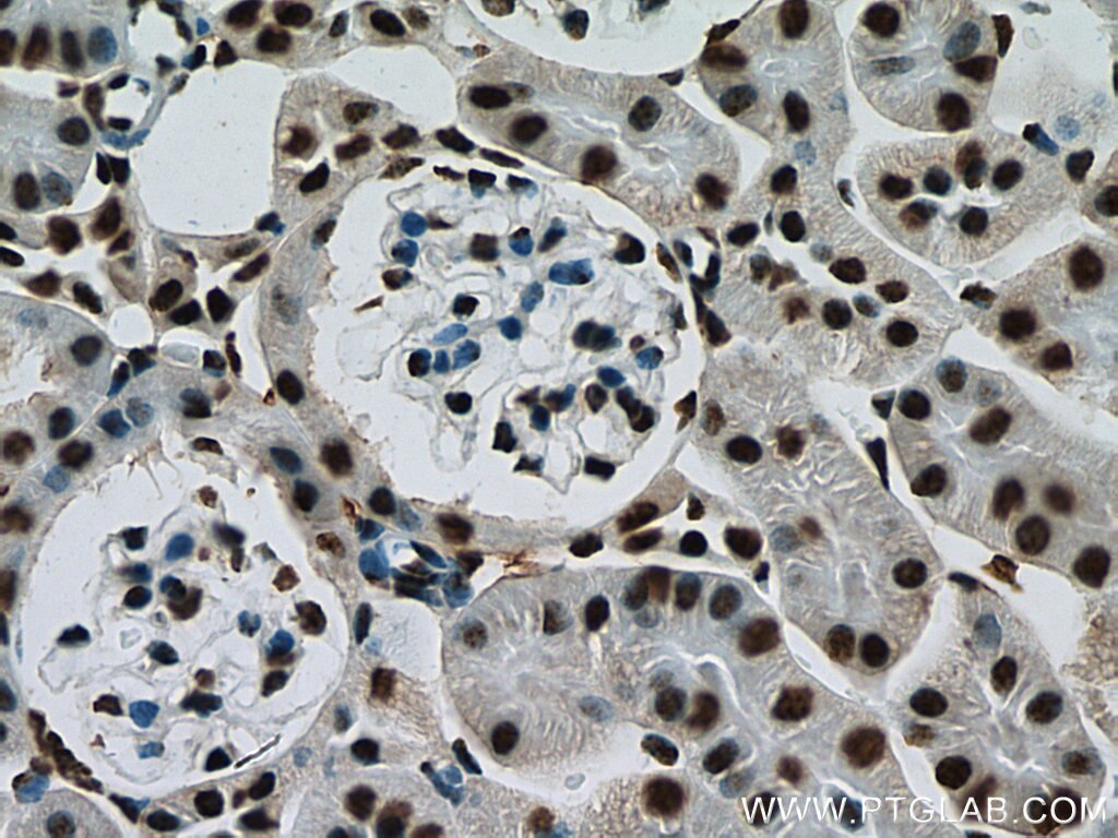 Phospho-Histone H3 (Ser10) antibody (66863-1-Ig) | Proteintech