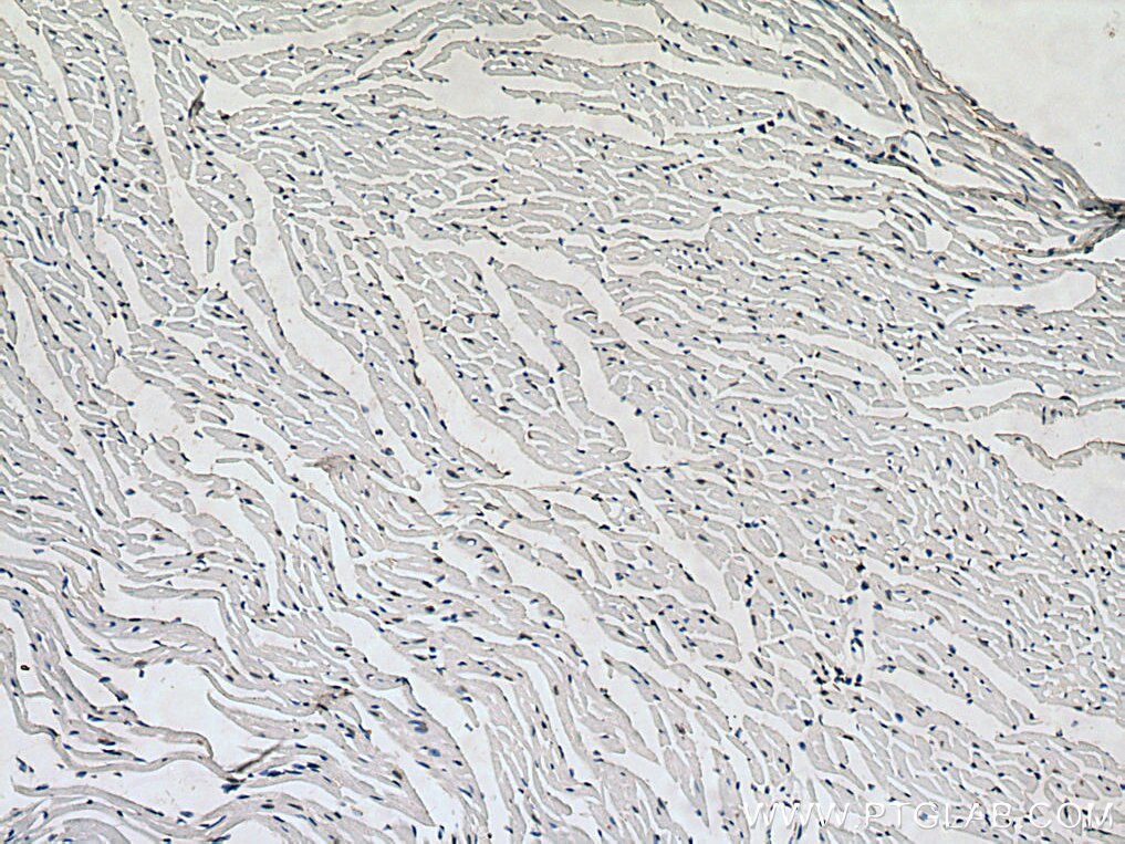 Phospho-Histone H3 (Ser10) antibody (66863-1-Ig) | Proteintech